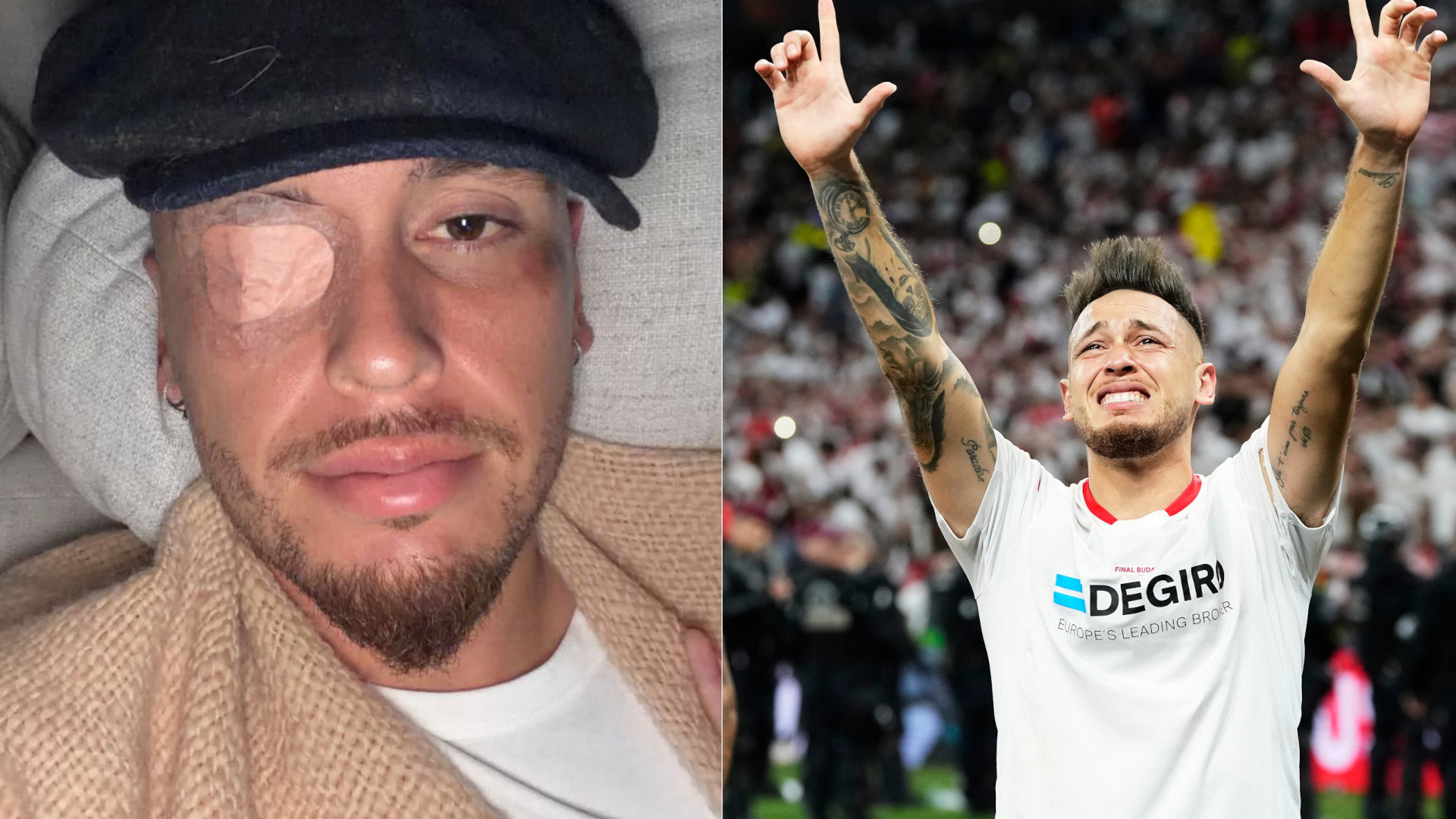 Monterrey player Lucas Ocampos suffers facial paralysis caused by a ...