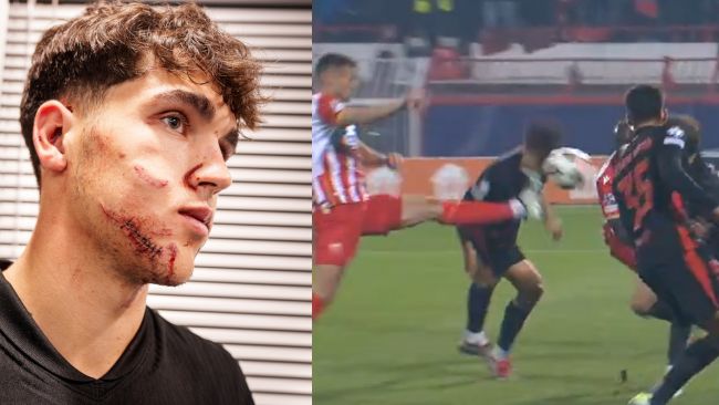 Ten stitches and a smile: Cubarsí recovers after scary kick to the face ...